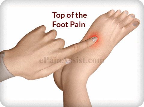 Top Of The Foot Pain GIFs - Get the best GIF on GIPHY