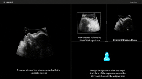 Ultrasound-scan GIFs - Get the best GIF on GIPHY