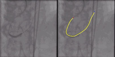 Fluoroscopy GIFs - Find & Share on GIPHY