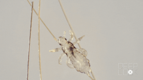 Hair Lice GIF by PBS Digital Studios - Find & Share on GIPHY