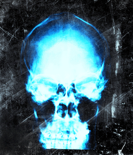 X Rays GIFs - Get the best GIF on GIPHY