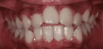 Progressive Orthodontic Seminars GIF - Find & Share on GIPHY