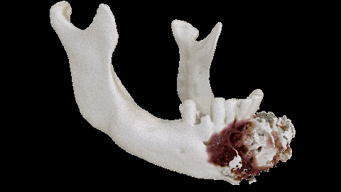 Mandibula GIFs - Get the best GIF on GIPHY