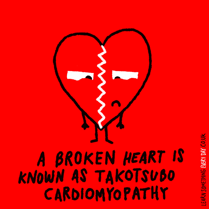 Cardiomyopathy GIFs - Get the best GIF on GIPHY