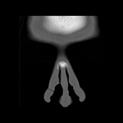 Ct Scans GIFs - Find & Share on GIPHY