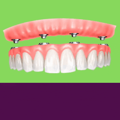 Teeth Dentist GIF by GOU Franquias - Find & Share on GIPHY