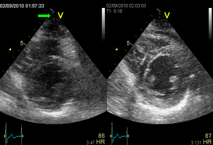 Echocardiography GIFs - Get the best GIF on GIPHY