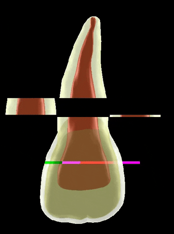 Teeth Tooth GIF by proj.implanto.ufpel - Find & Share on GIPHY
