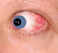 Eye Contact Lenses GIFs - Get the best GIF on GIPHY