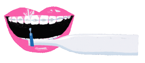 BRACES GIFs on GIPHY - Be Animated